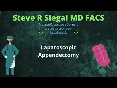 Laparoscopic Appendectomy