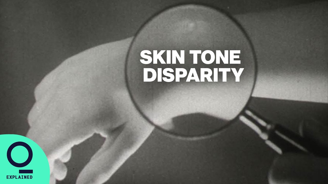 Ending Skin Tone Disparity In Dermatology
