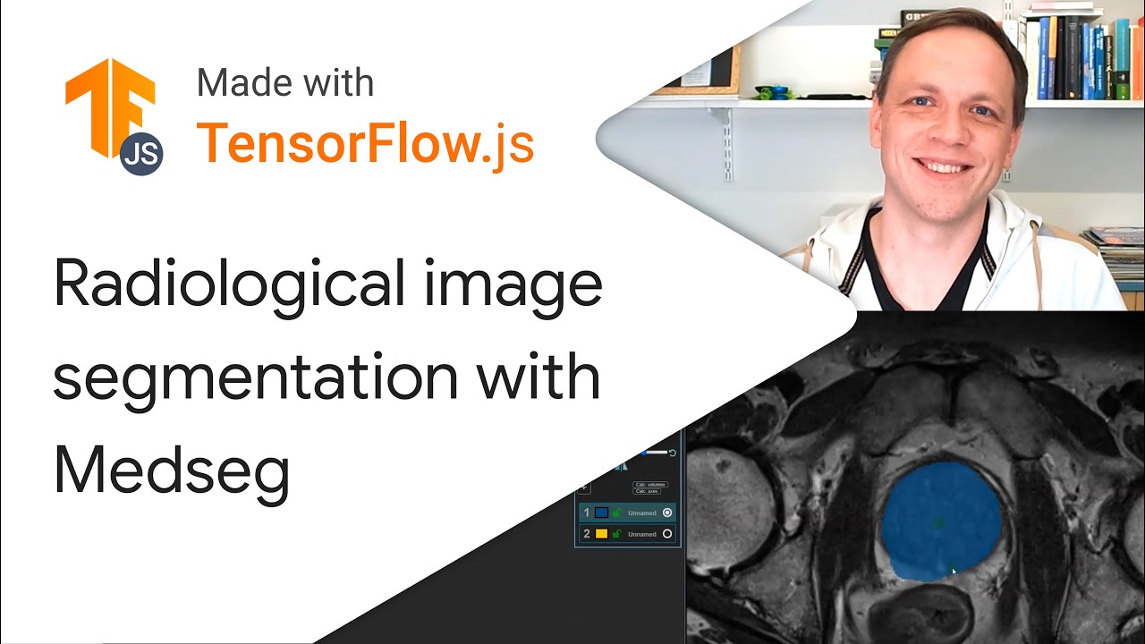 Radiological image segmentation with Medseg - Made with TensorFlow.js