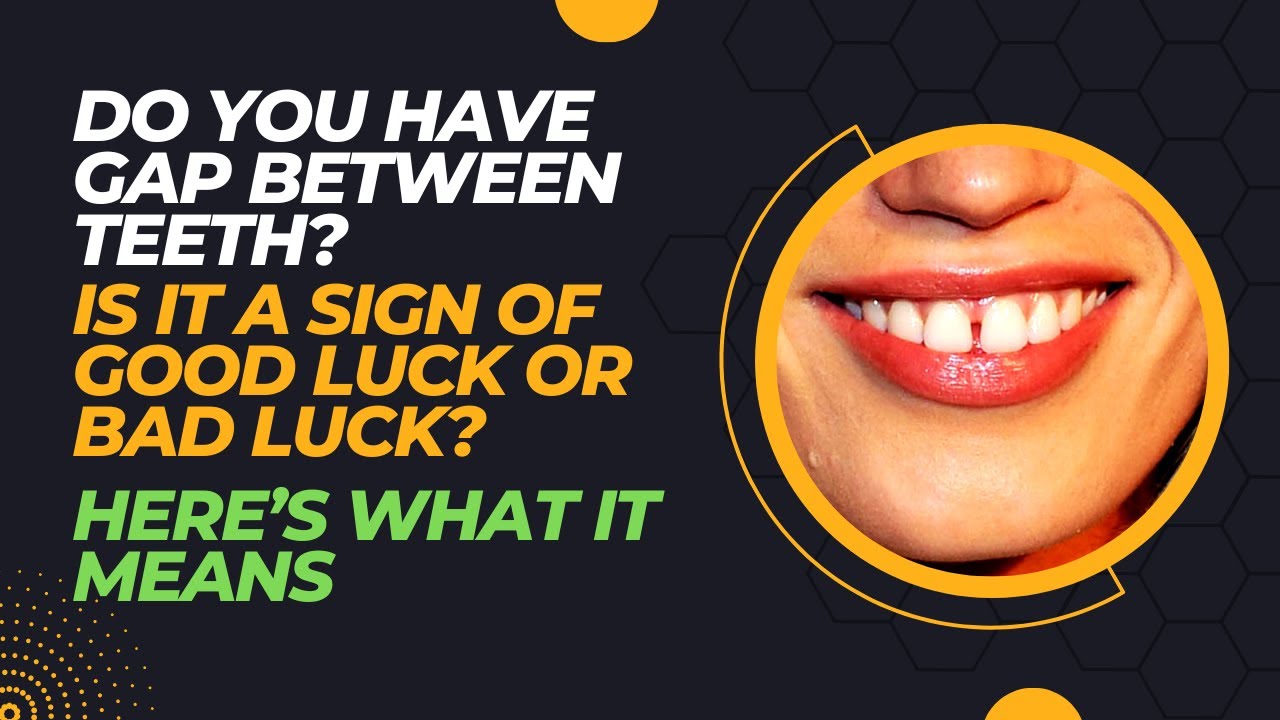 Do You Have Gap Between Teeth? Is It a Sign of Good Luck or Bad Luck? Here’s What It Means || FG
