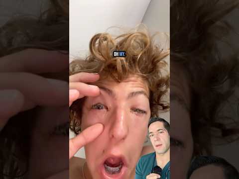 What’s in his eyes?!