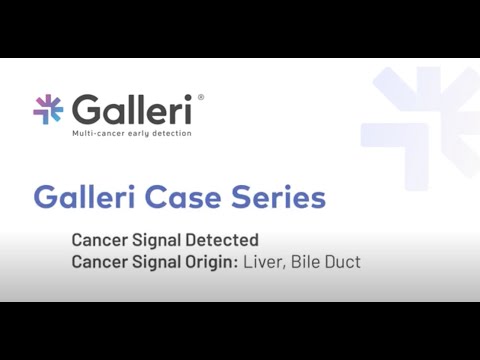 Dr. Poliak describes a liver cancer case detected by the Galleri test
