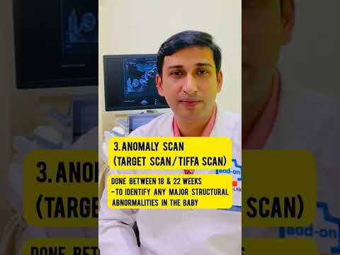 What are the most important Pregnancy scans? | Dr. Sunil Kumar G S | #shorts #ultrasound #pregnancy