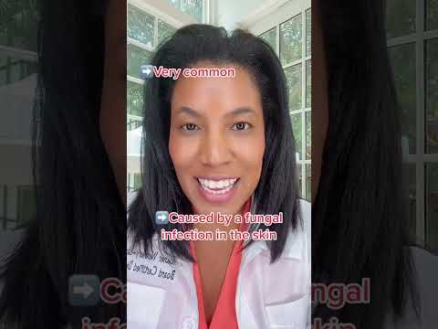 Tips On How To Treat Athlete's Foot