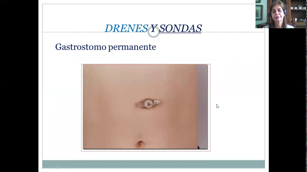 Drenes y Sondas Mod 2