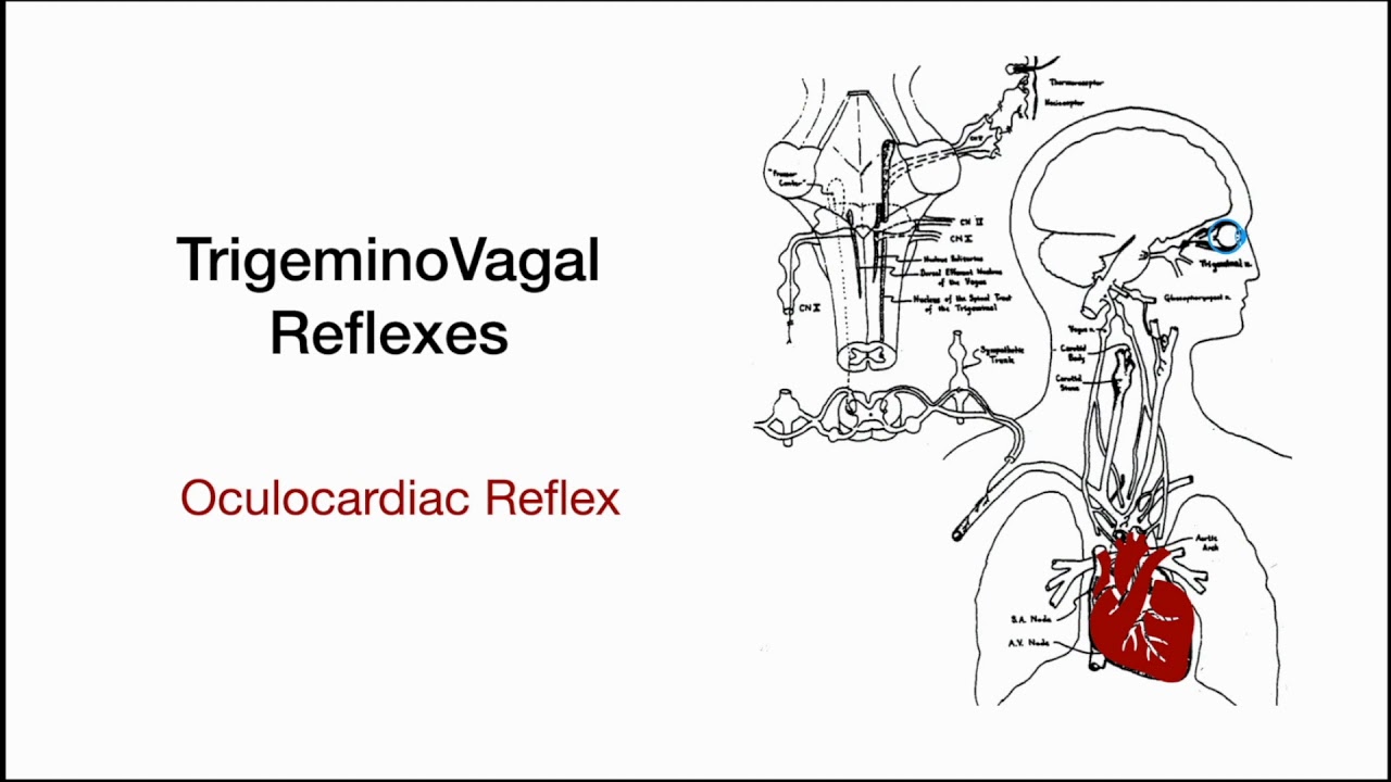 Oculocardiac Reflex During Rop Exams - Video abstract [ID 288043]