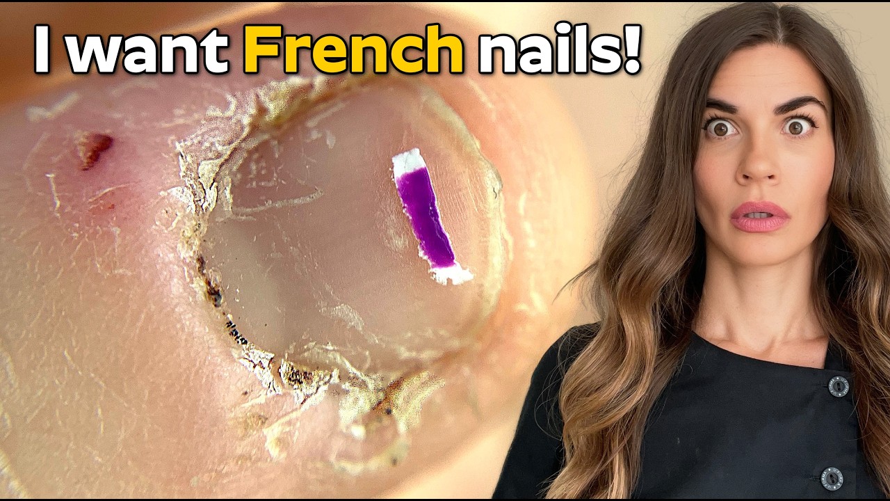 I Tried Every Bitten Nail Fix (Here’s What Works)