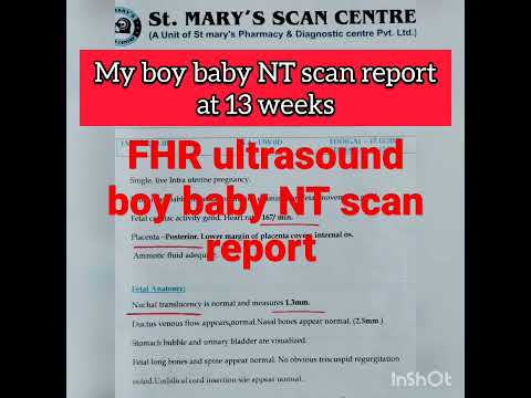 Ultrasound NT scan report boy baby at 13 weeks #shorts #boybaby #genderreveal #ultrasound