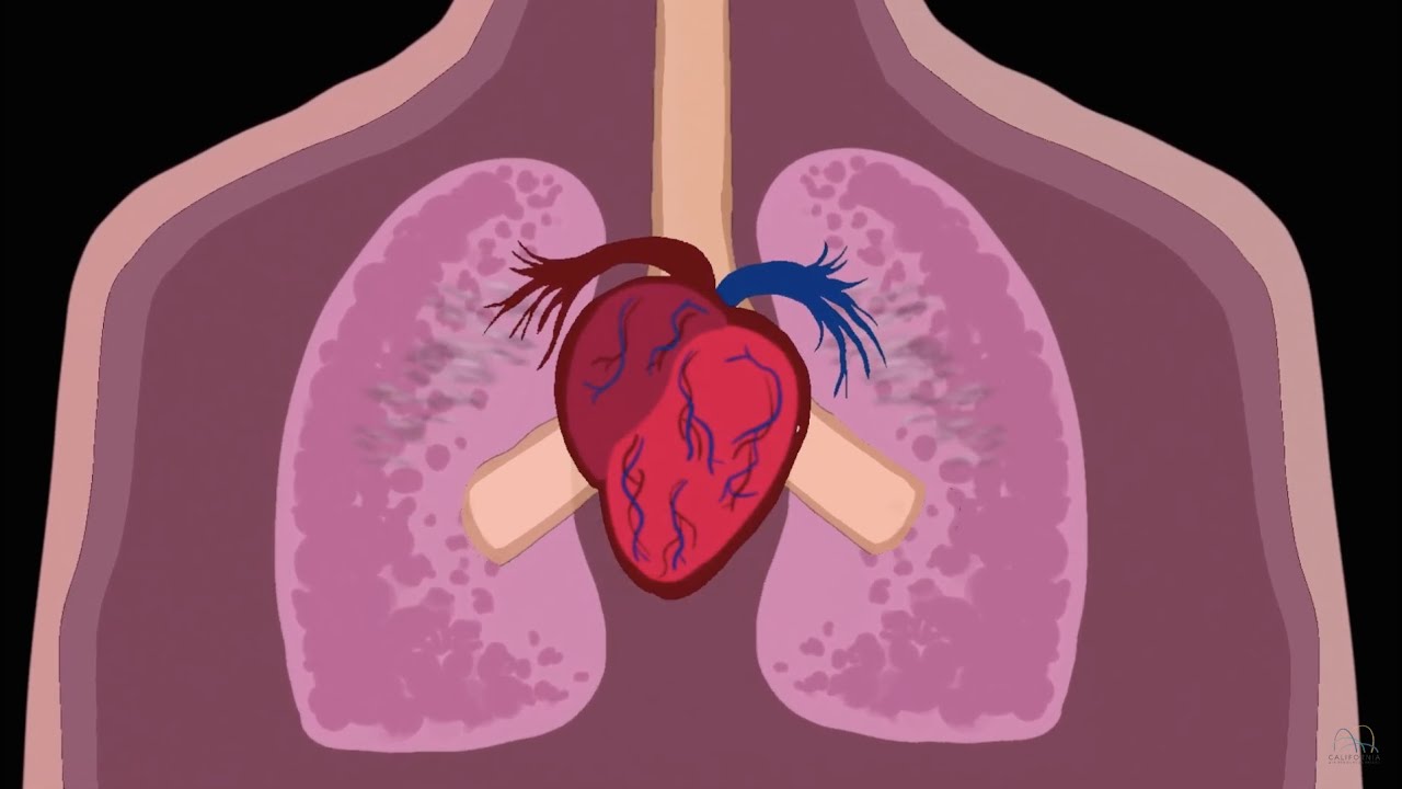 Efectos sobre la salud de las contaminaciones atmosféricas