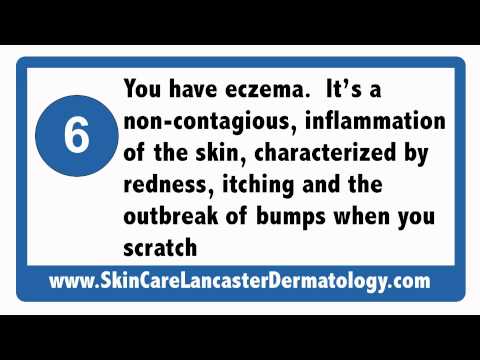 Eczema Lancaster PA - Talk to your Lancaster Dermatology Doctor about treating your eczema