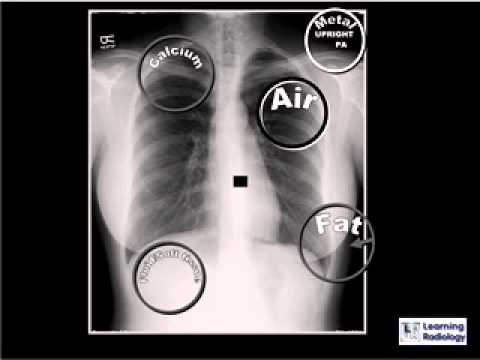 01 The 5 Basic Radiographic Densities