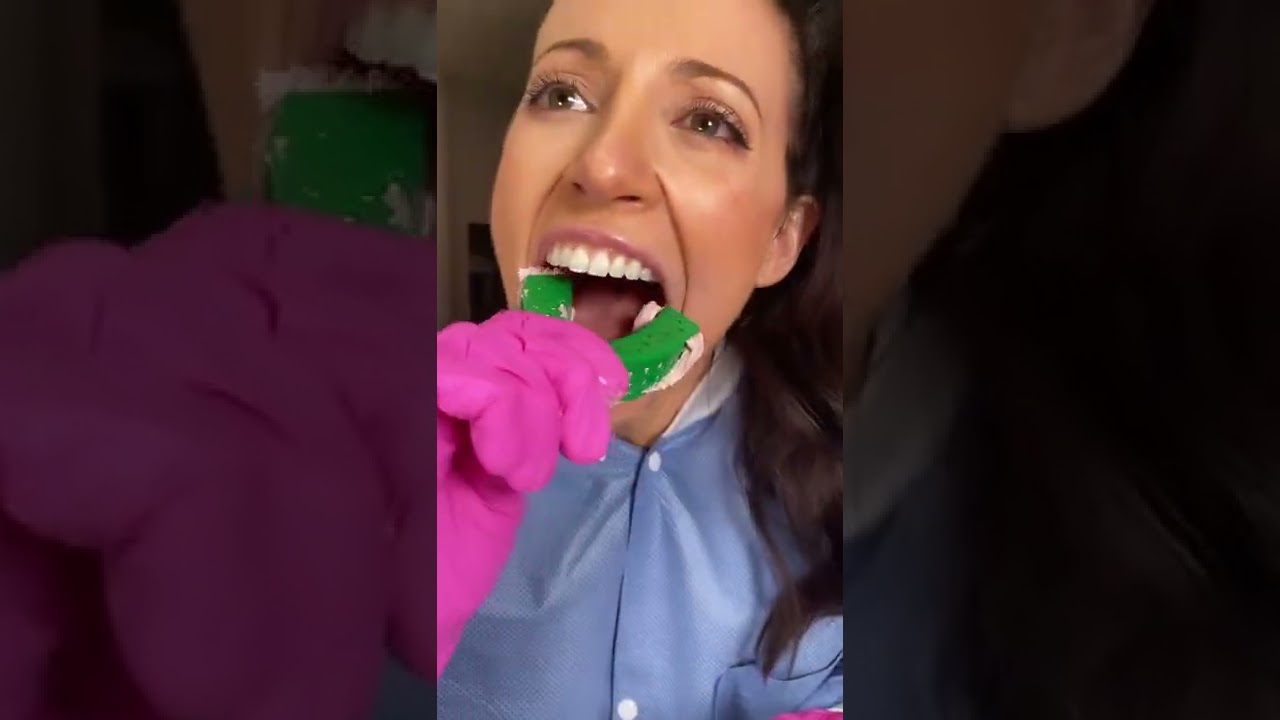 taking my own teeth impression! #shorts