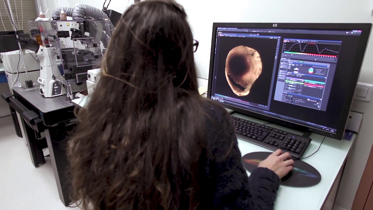 Studying the molecular mechanisms controlling cell death over ischemia-reperfusion