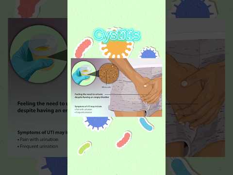 Expand Your Vocabulary Mastery: CYSTITIS - MEDICAL DEFINITION