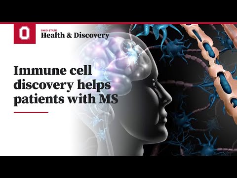Immune cell discovery helps patients with MS | Ohio State Medical Center