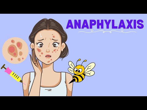 Anaphylaxis: Definition, Pathophysiology, Treatment (Anaphylaxis 101)