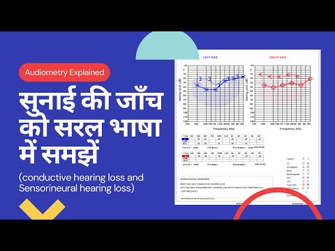 Hearing test explained | सुनाई की जाँच ।Deafness test in Hindi | Pure tone Audiometry interpretation