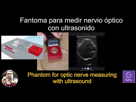 STL file Eye Phantom 2.0 for ultrasound scanning / Fantoma de ojo 2.0 ...