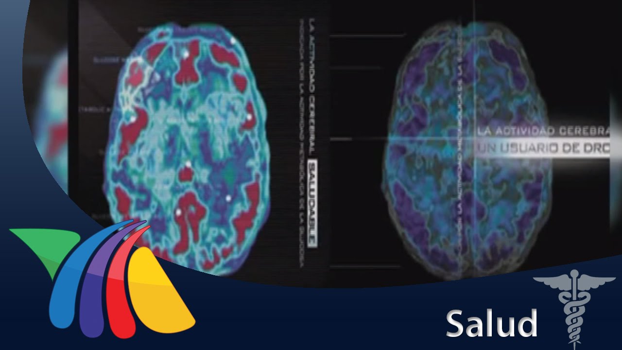 Efectos de las drogas en el cerebro | Noticias de Salud