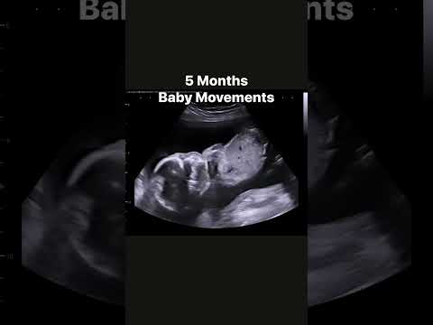 5 month baby movements #jerbearimaging #ultrasound #stephenville #wecometoyou