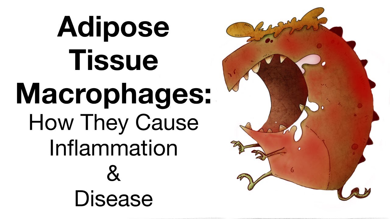 Adipose Tissue Macrophages:  How They Cause Inflammation and Disease