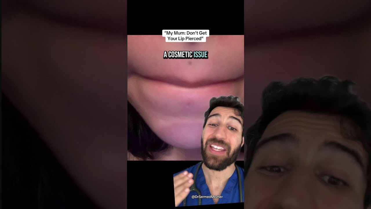 “Mi mamá: No te perfores el labio” #ignorada