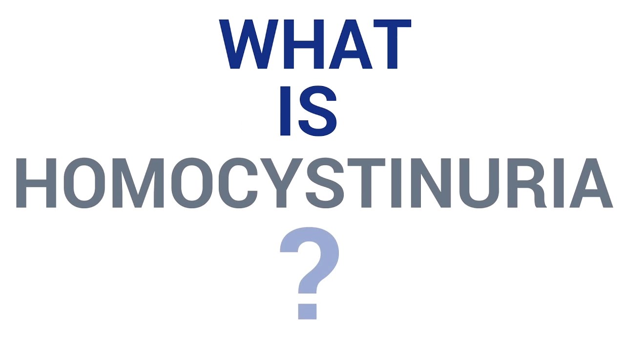 Homocystinuria Infographic