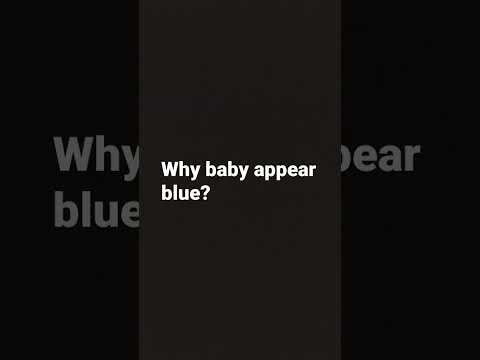 Blue babies| deoxygenated bloodstream |#satisfiya#imrankhanworld#cyanosis#medicos#anatomy#shortsfeed