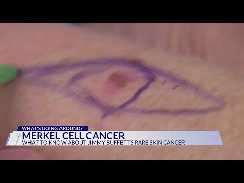 What is Merkel cell carcinoma?