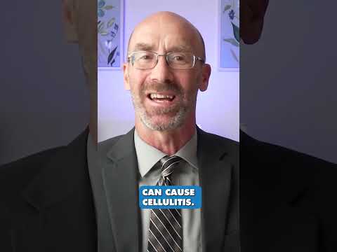 Cellulitis-what CAUSES-the infection?
