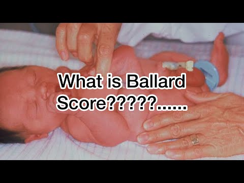 What is Ballard Score.......#neetpg|AIIMS PG|GIPMER|PGI|Paediatric|Medicine.....