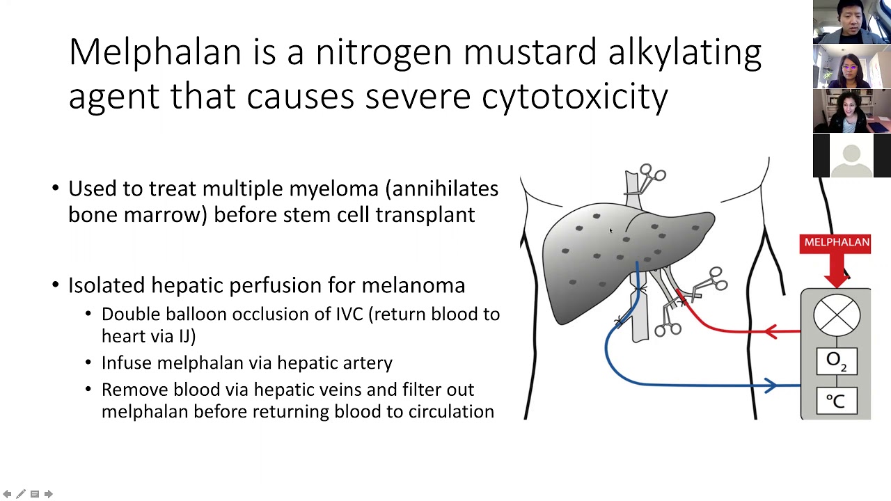 Treating melanoma mets with Melphalan hepatic perfusion- a novel IR technique!