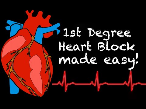 EMS Cardiology || Tachy Tuesday: 1st Degree Heart Block in EMS