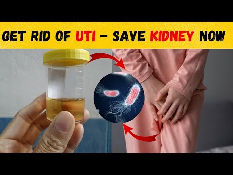 Reason for your Painful Urination