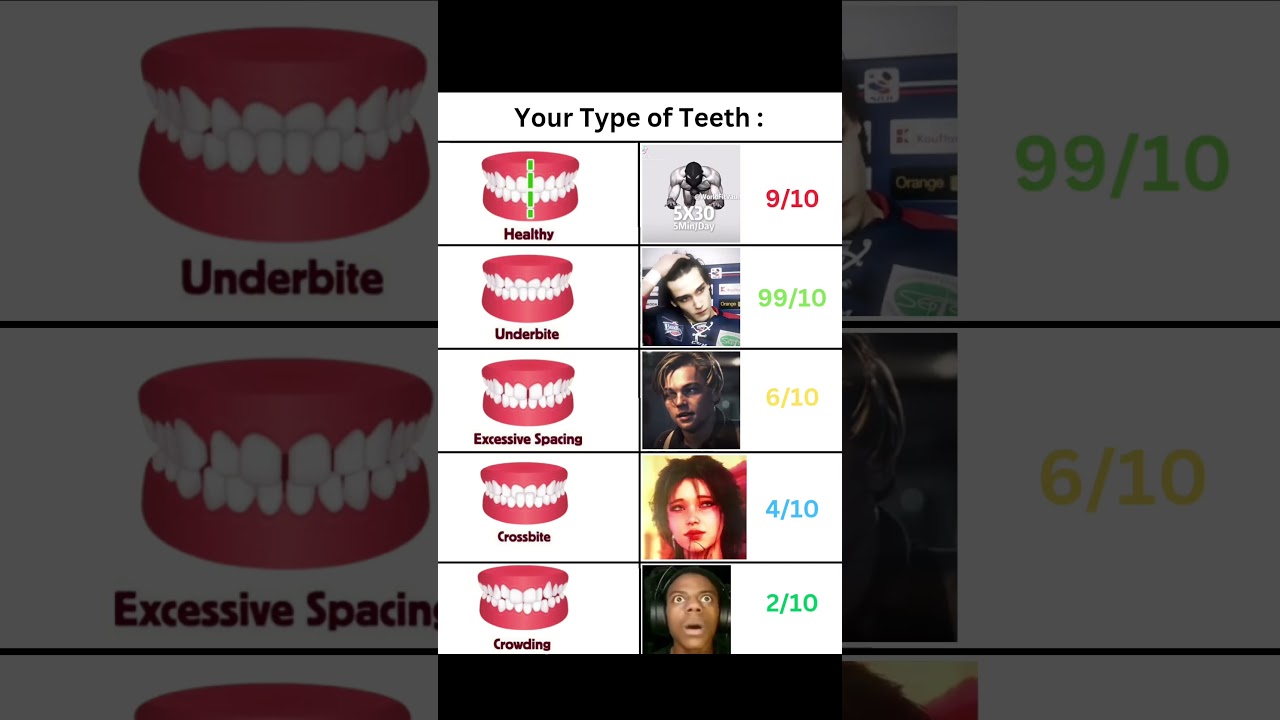 What is your Teeth Type 👀