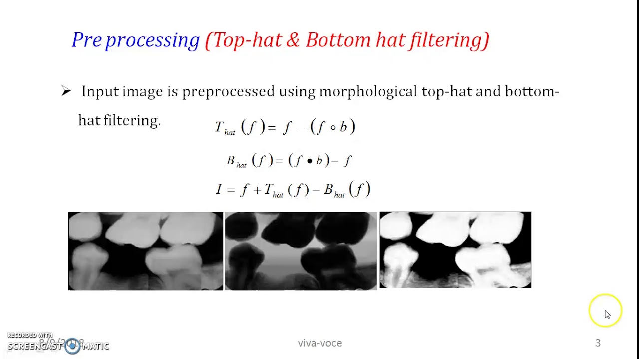 Top Hat and Bottom Hat Filtering