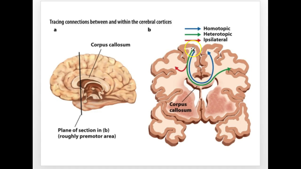 Chapter 4 Hemispheric Specialization