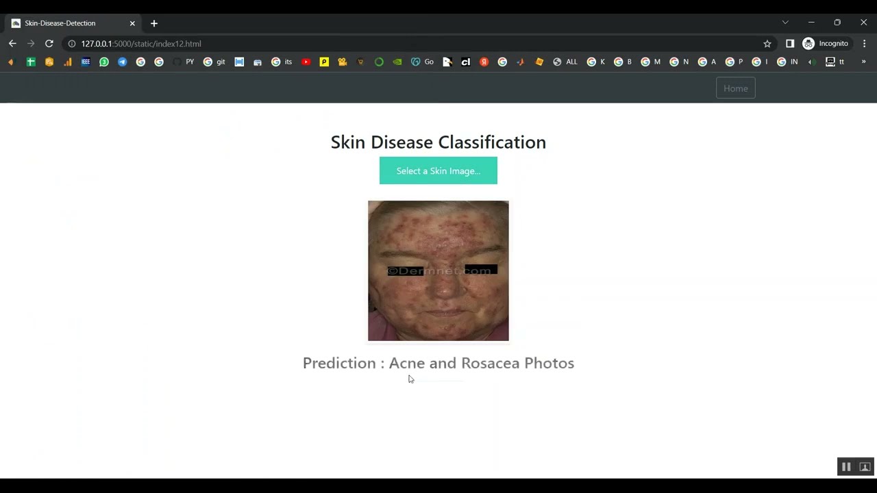 Multi Task and Few Shot Learning Based Fully Automatic Deep Learning ...
