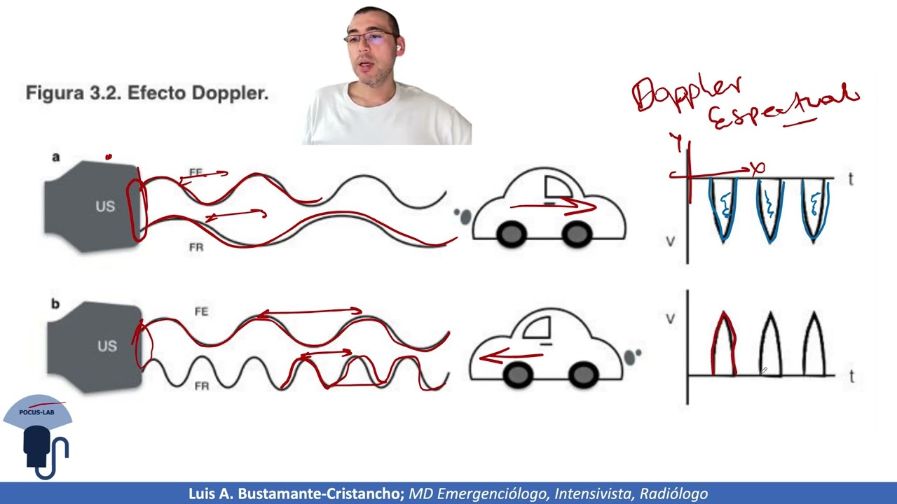 Principios físicos del Doppler