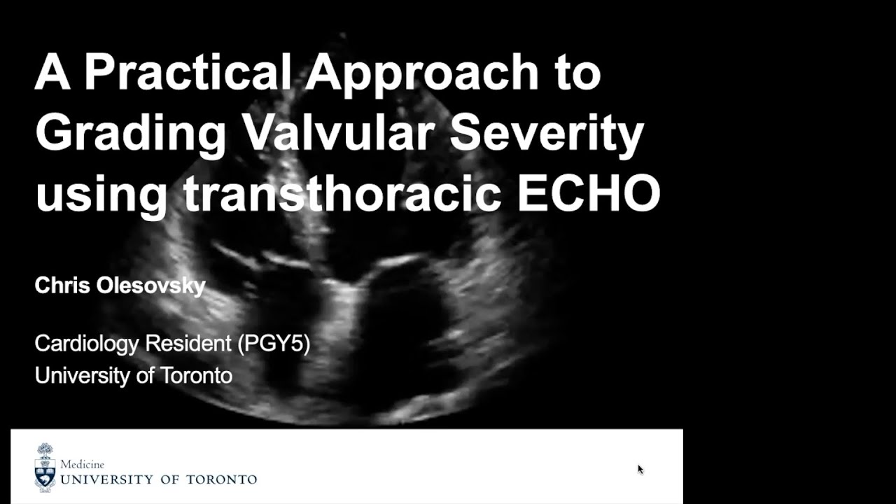 A practical approach to grading valvular severity using transthoracic echo.
