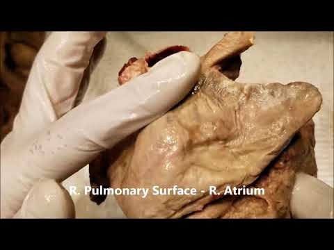 HEART Morphology APEX BASE P SINUSES CORONARY SULCUS Clinical Aspects – Sanjoy Sanyal
