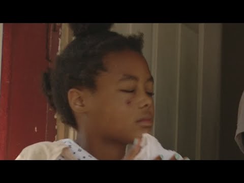 Columbus girl, 9, in hospital after being hit by stray bullet