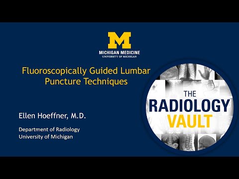 Fluoroscopically Guided Lumbar Puncture Techniques