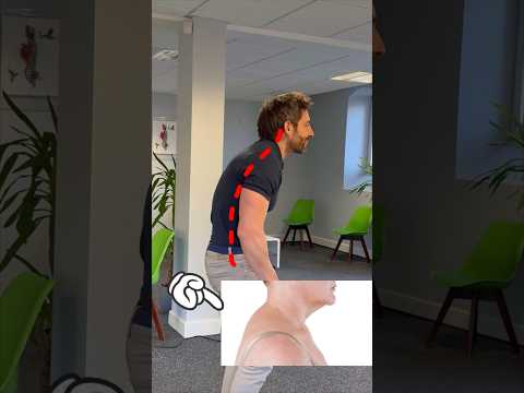 Fix posture and correct neck hump with this neck stretcher. #posture #posturecorrection #neckhump