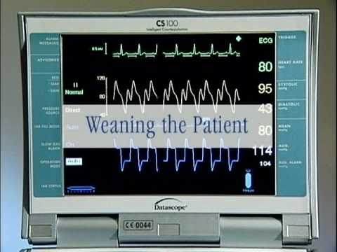 Intra-Aortic Balloon Pump (IABP) Datascope CS100 Forums | MedWrench