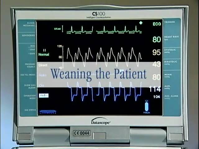 IABP Machine - Iabp Datascope Cs300 Cs100 98xt Maquet Wholesale Trader ...