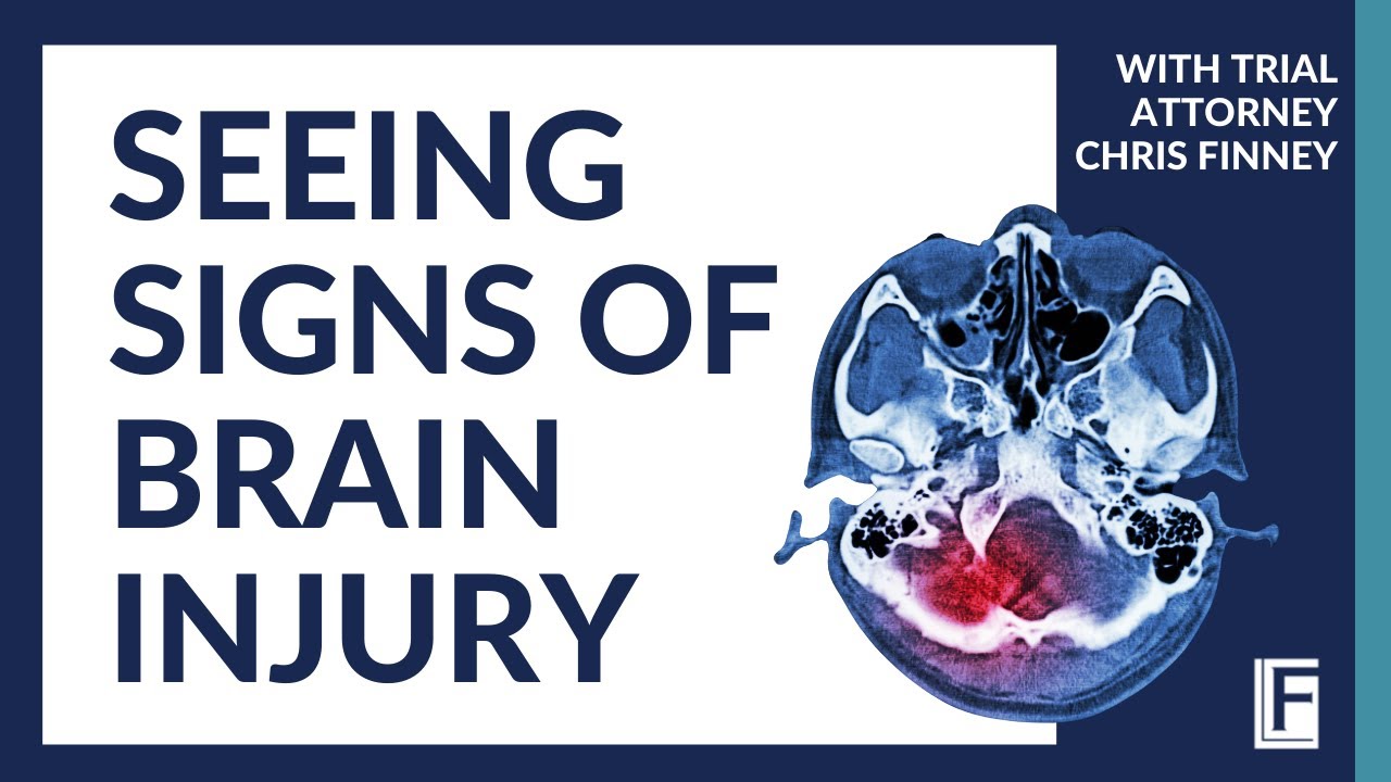 How Long Does it Take to Show Signs of a Traumatic Brain Injury? | St ...