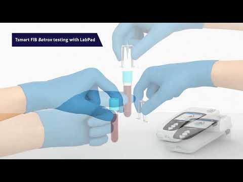 Tsmart FIB Batrox Testing with LabPad Evolution