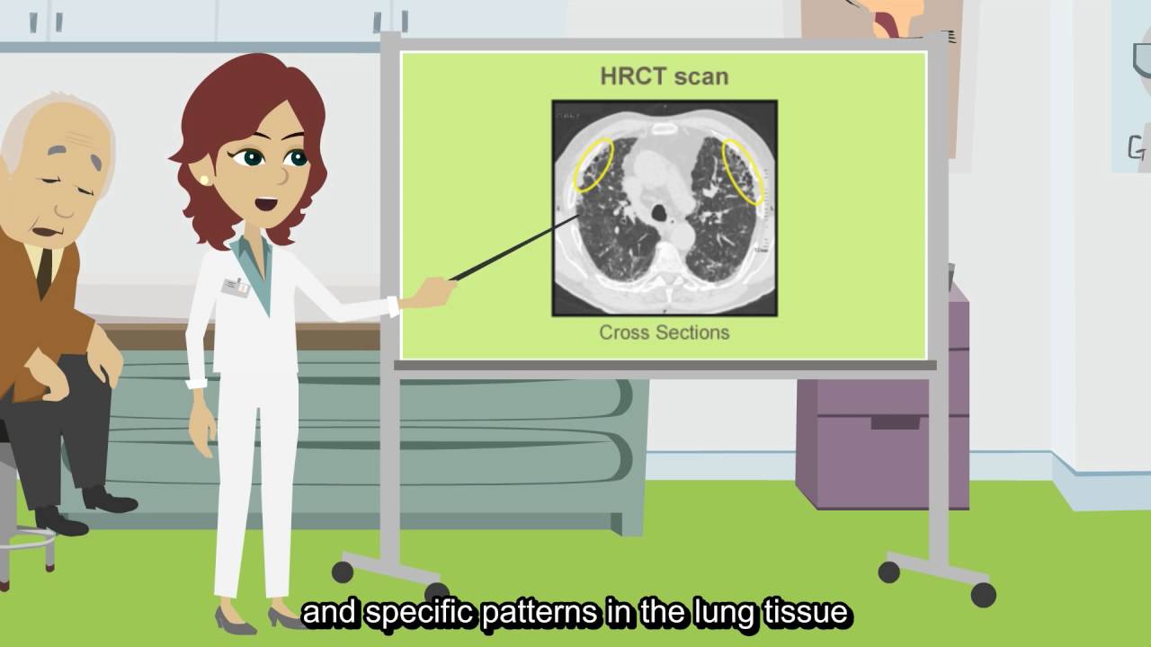 What is an HRCT scan