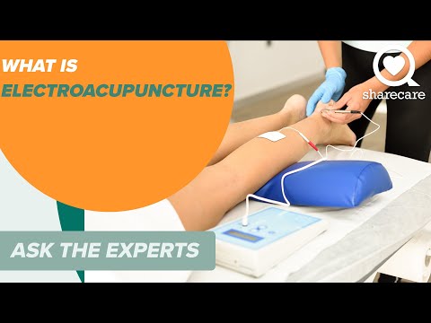 What is Electroacupuncture? | Ask The Experts | Sharecare
